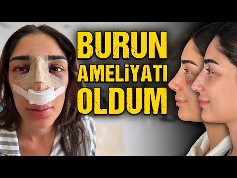 İki Haftalık Tüm Süreç | ÖNCESİ & SONRASI 👃 