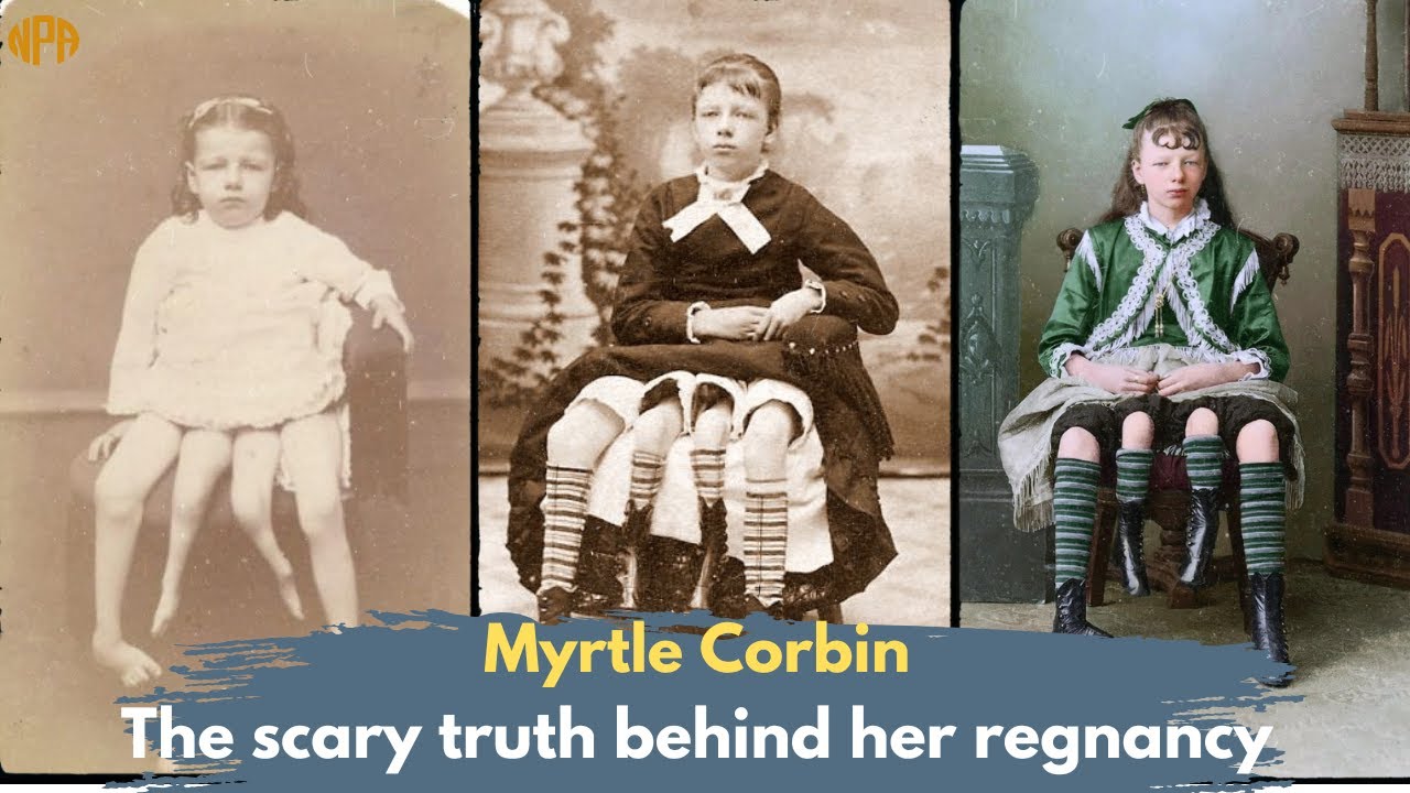 Myrtle Corbin Biography: The scary truth behind her pregnancy - YouTube