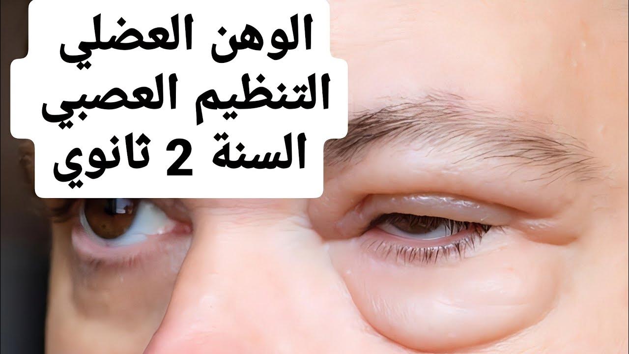 حل تمرين حول الوهن العضلي... السنة الثانية ثانوي وحدة التنظيم العصبي ...