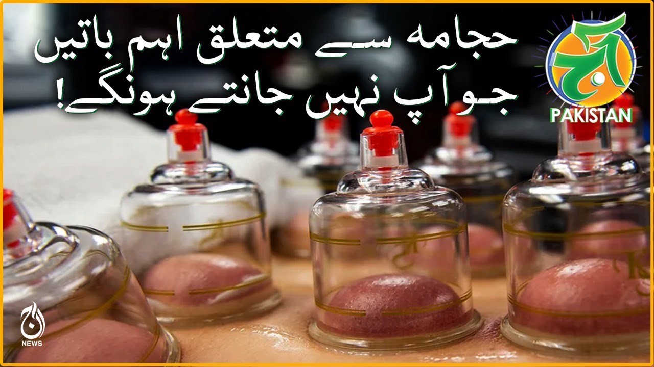 What is the purpose of Hijama? | Is Hijama allowed in Islam? | Benefits ...