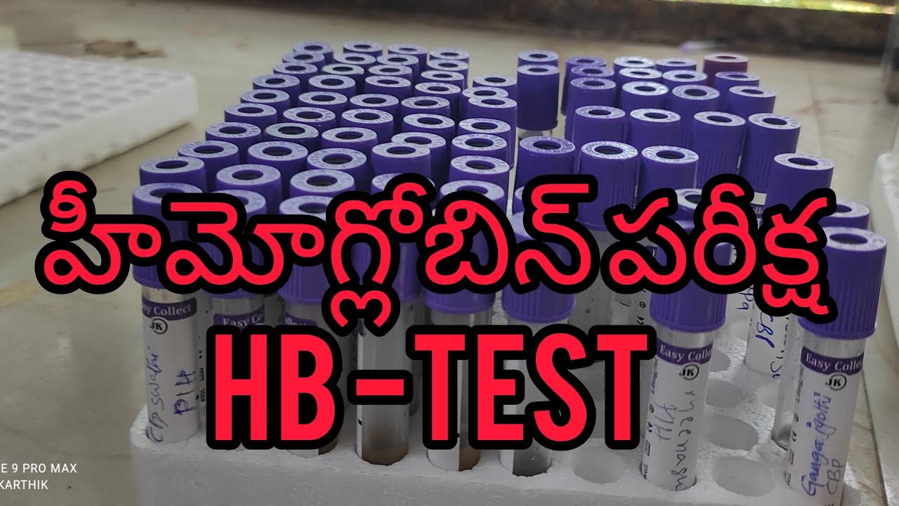 Hb test# Lab#srinath #youtubevideos - YouTube