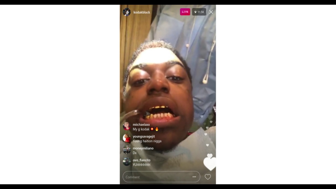 Kodak black gets his Gold Teeth removed] Live on IG 6 12 2017 - YouTube