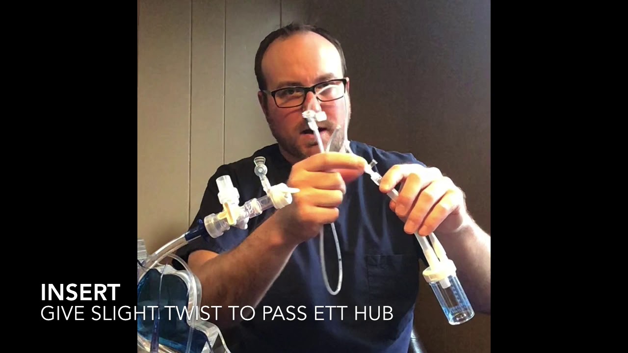 Avanos BAL Cath with Liberator System - YouTube