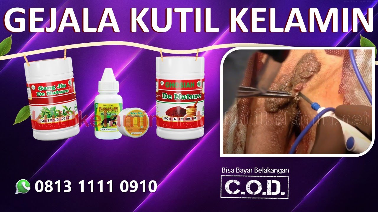 Gejala Kutil Kelamin Awal Atau Ringan Hingga Kronis Di Dubur - Zakar ...