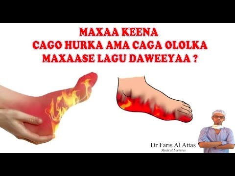 MAXAA KEENA CAGO HURKA AMA CAGA OLOLKA MAXAASE LAGU DAWEEYAA?  Dr faris