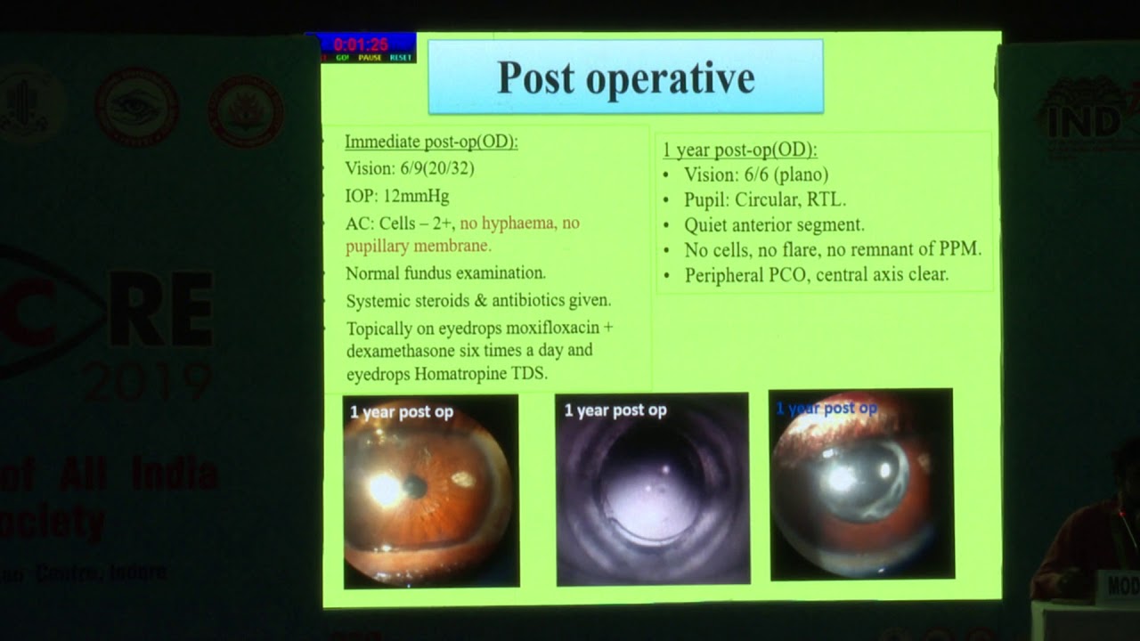 AIOC2019 Hyde Park IV FP1814 Breaking through an Arborizing Network Dr ...