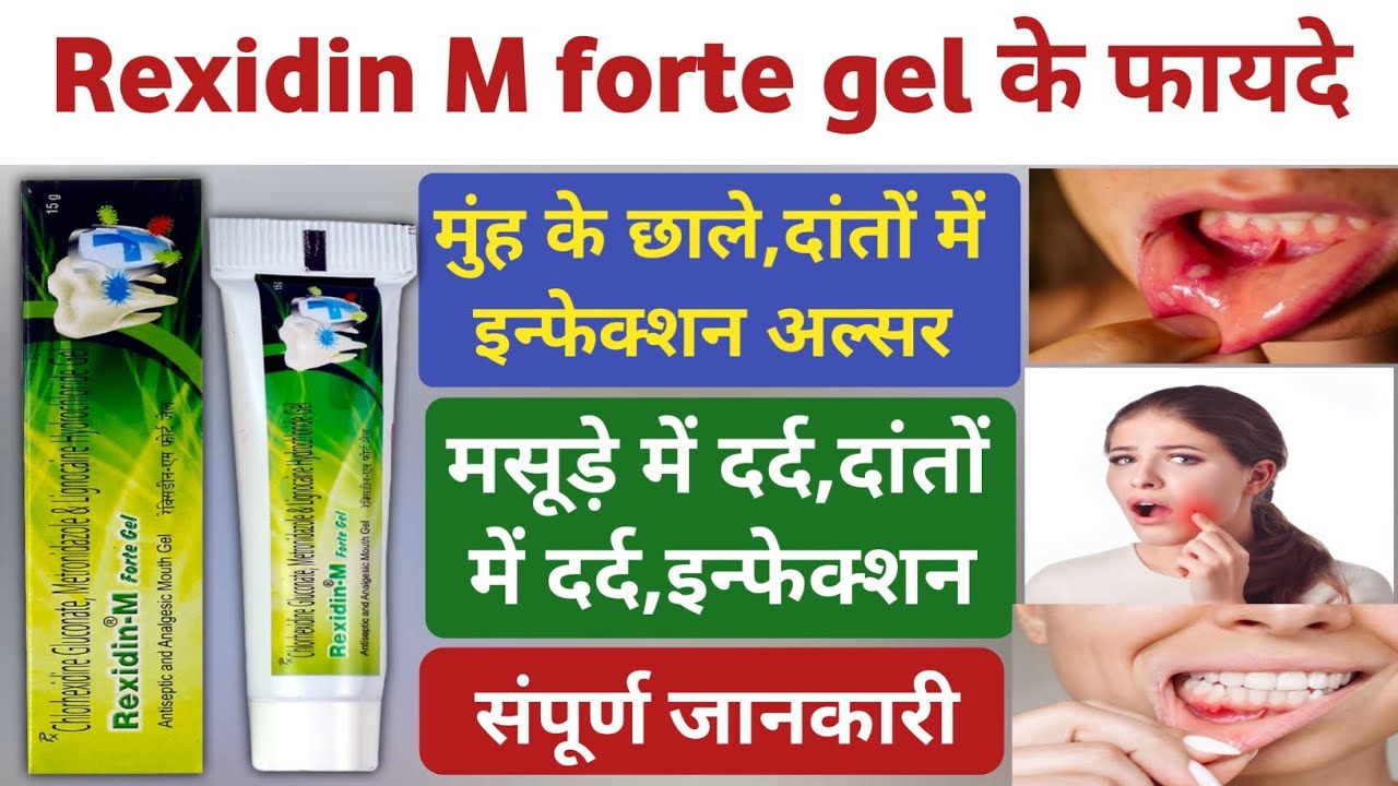 Rexidin m forte gel ke fayde | Rexidin m forte gel how to use | Rexidin ...