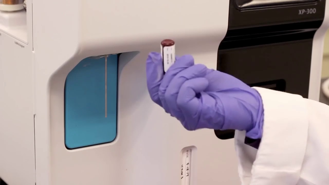 Sysmex XP 300™ Automated Hematology Analyzer - YouTube