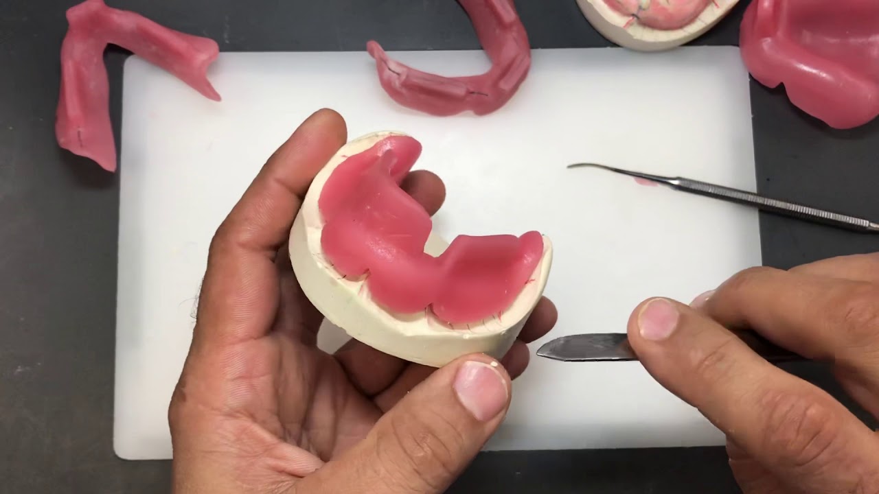 8b) Removal of Lower Custom Tray - YouTube