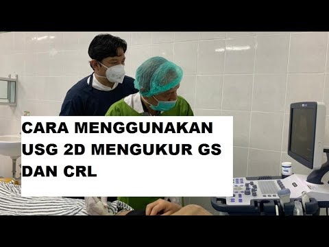 CARA MENGUNAKAN USG 2D UNTUK MENGUKUR PENGUKURAN GS DAN CRL - YouTube