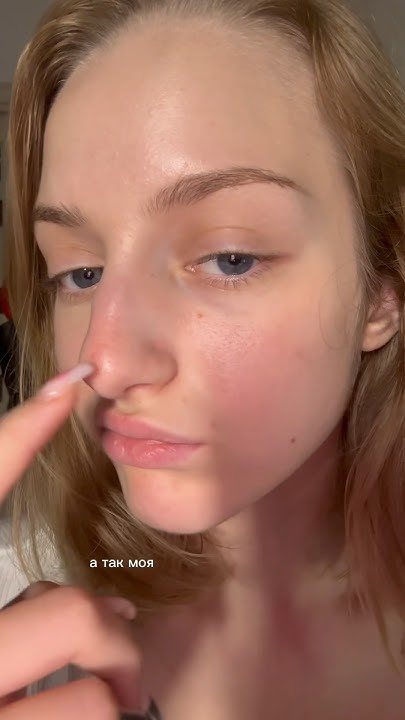 как я спасла свою кожу? #уходзакожей #уходзалицом #skincareblogger # ...