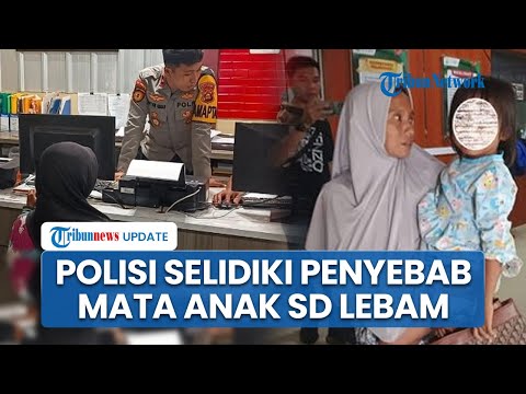 Siswi SD di Palembang Alami Mata Merah dan Lebam Sepulang Sekolah, Polisi Lakukan Penyelidikan