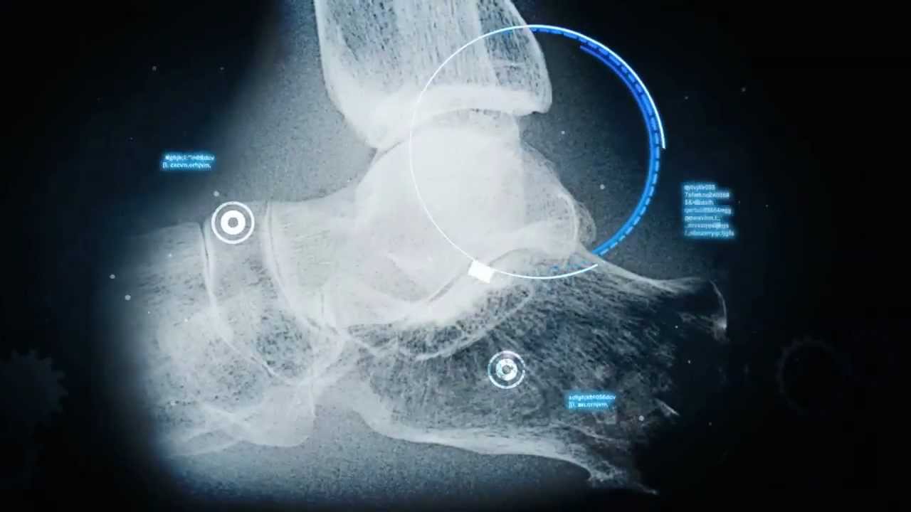 Teledyne DALSA: Bringing Advanced X-Ray Imaging to Life - YouTube