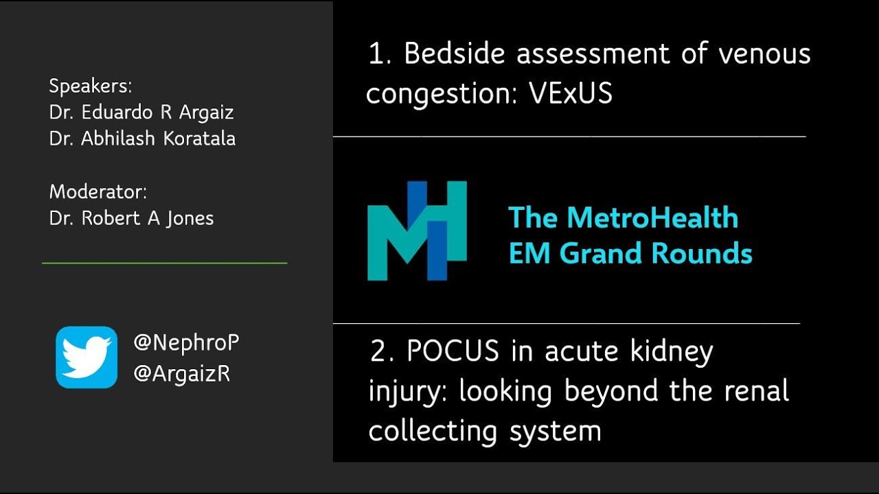 Venous Excess Doppler Ultrasound (VExUS) | POCUS in AKI | Dr. Argaiz ...