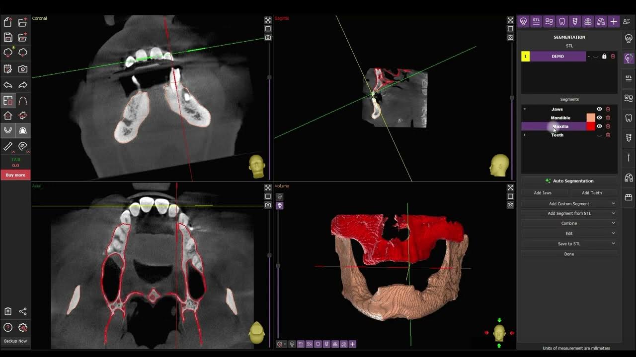 Segmentation. Extracting segments - YouTube