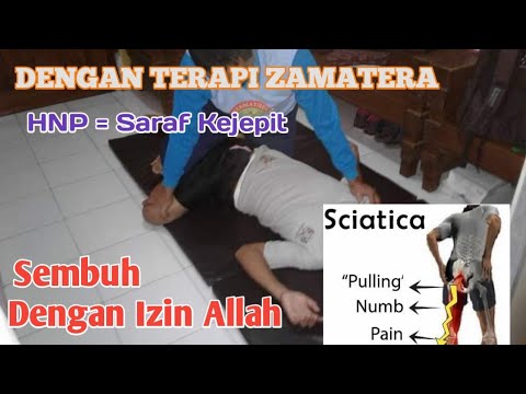 Cara Mudah Atasi Saraf Kejepit | Terapi Zamatera - YouTube