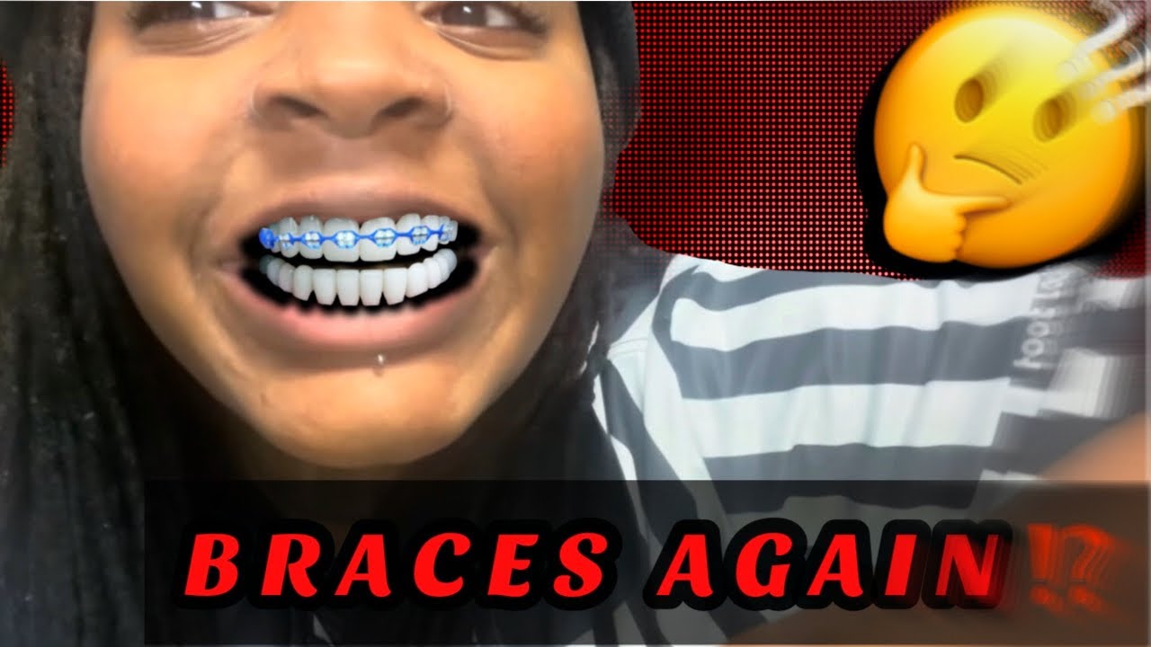BRACES AGAIN| REPAIR THE NEXT DAY| PERFECT 😀FOR THE BIG DAY| WILL I HET ...