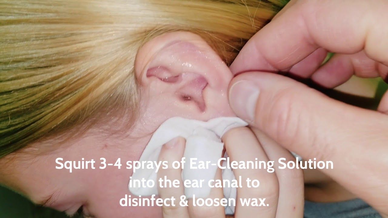 How To Properly Use The UtilityTip System For Safe Ear Cleaning - YouTube