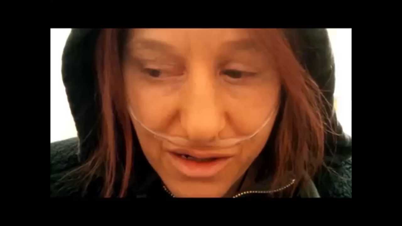 Upcoming Surgery 4.4.14: Pacemaker Lead Extractions, New Pacer and New ...