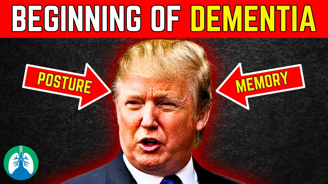 Top 10 Early Dementia Signs Most People Miss | Until It’s Too Late ...