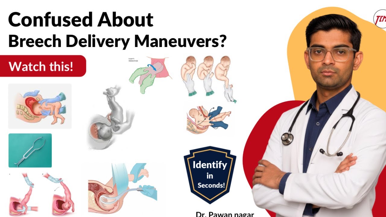 All Breech Delivery Maneuvers Explained Simply | Must-Watch for Exams ...