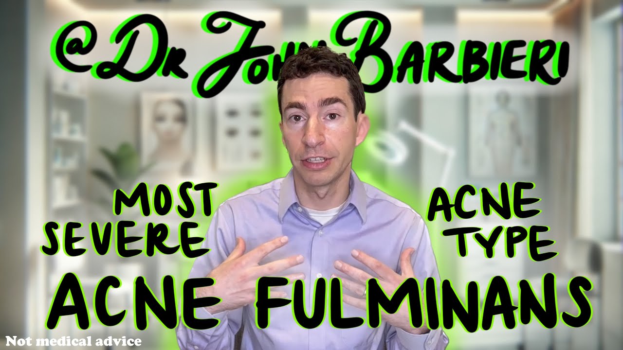 The most severe acne variant | acne fulminans | Dermatologist and acne ...