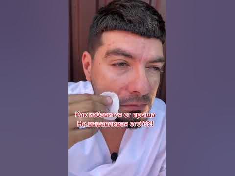 Как правильно выдавить прыщ? - YouTube