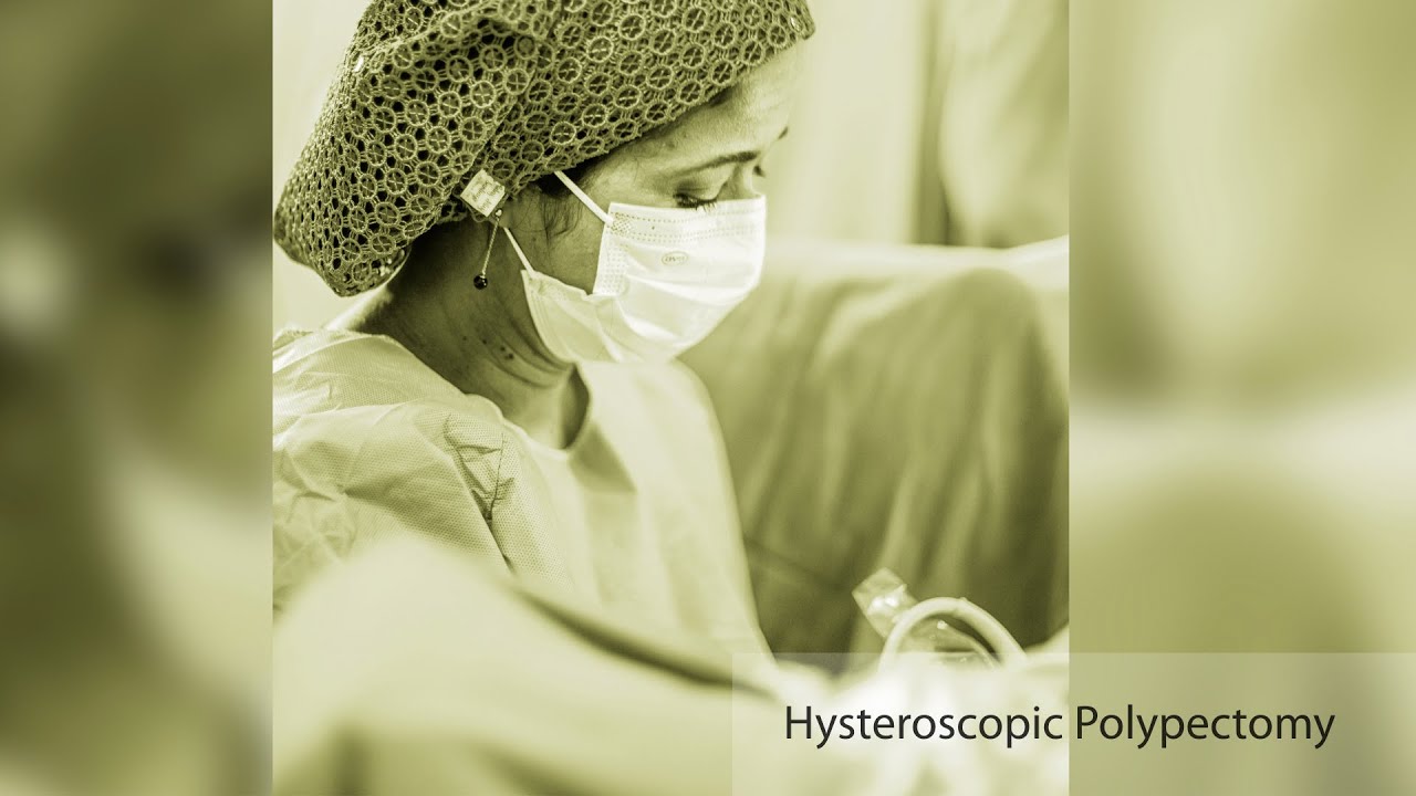 Hysteroscopic Polypectomy - YouTube