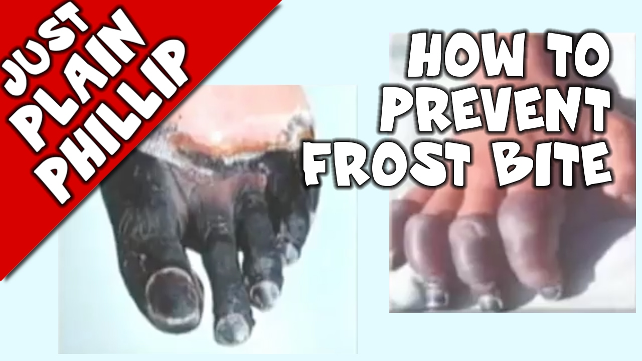 How to Prevent Frostbite - Winter Survival Concepts with Plain Phillip ...