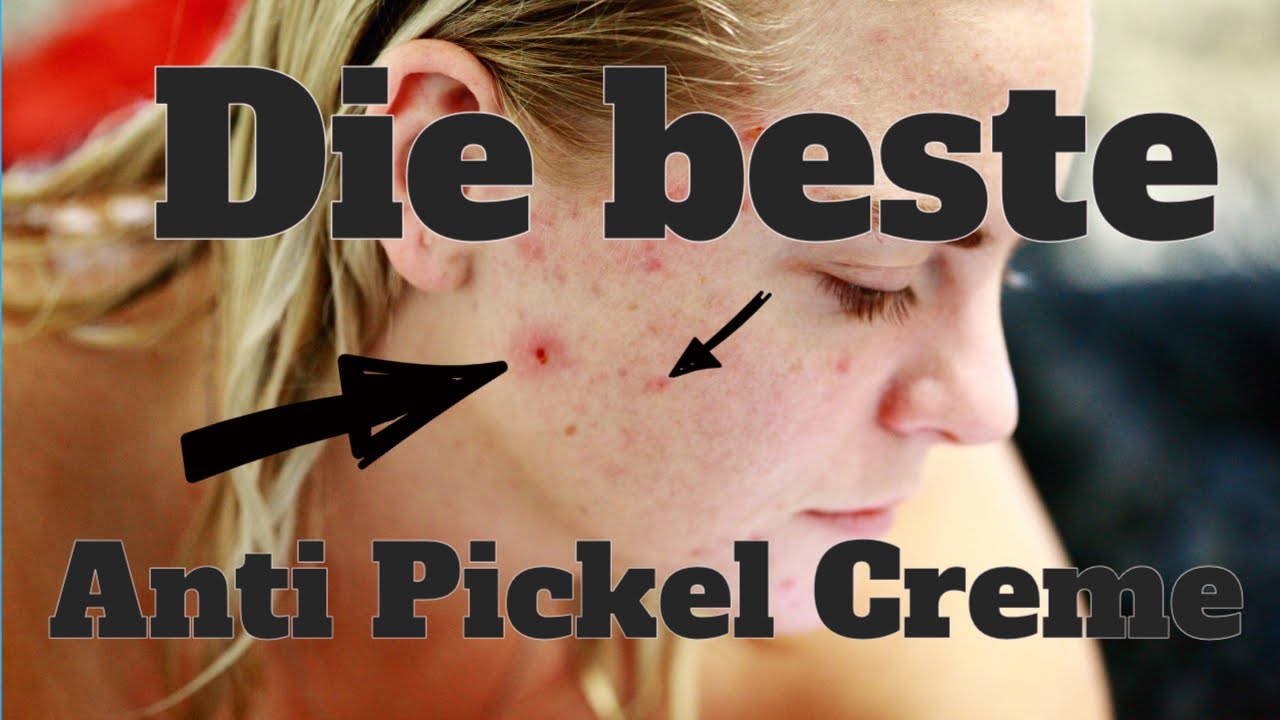 Die beste Anti Pickel Creme - Tipps gegen Akne - YouTube