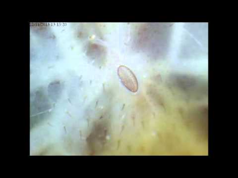 Caterpillar Under Digital Microscope - YouTube