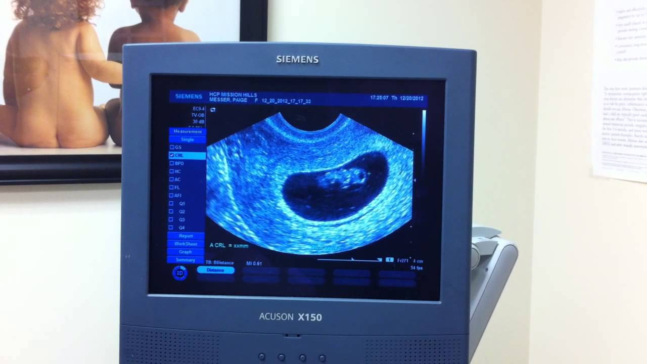 7 week 4 day ultrasound! - YouTube