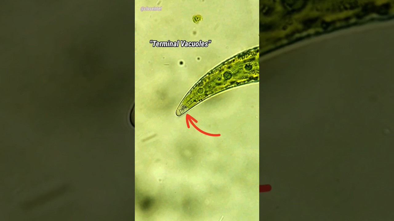Closterium Algae Under Microscope (Mystery Vibrating Crystals) - YouTube
