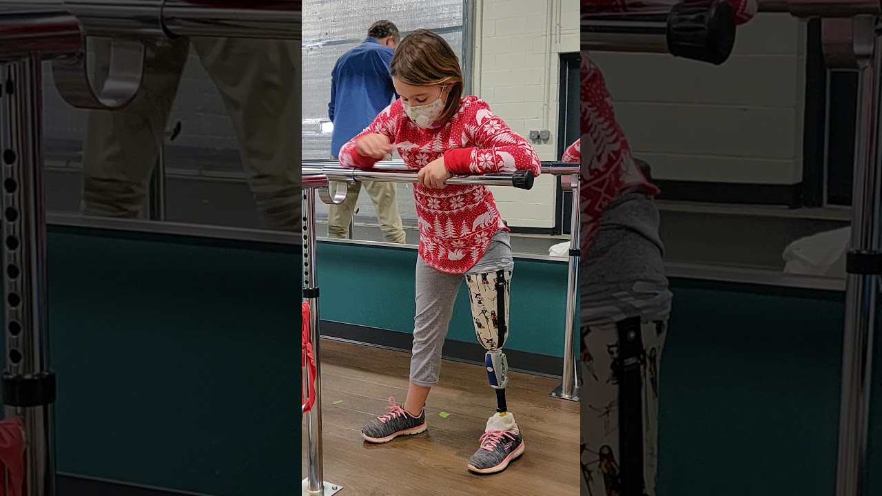 Romella's first prosthetic leg!!!!! - YouTube