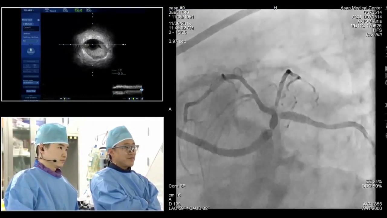 [COMPLEX PCI 2018] Live Case Demonstration 3 - YouTube