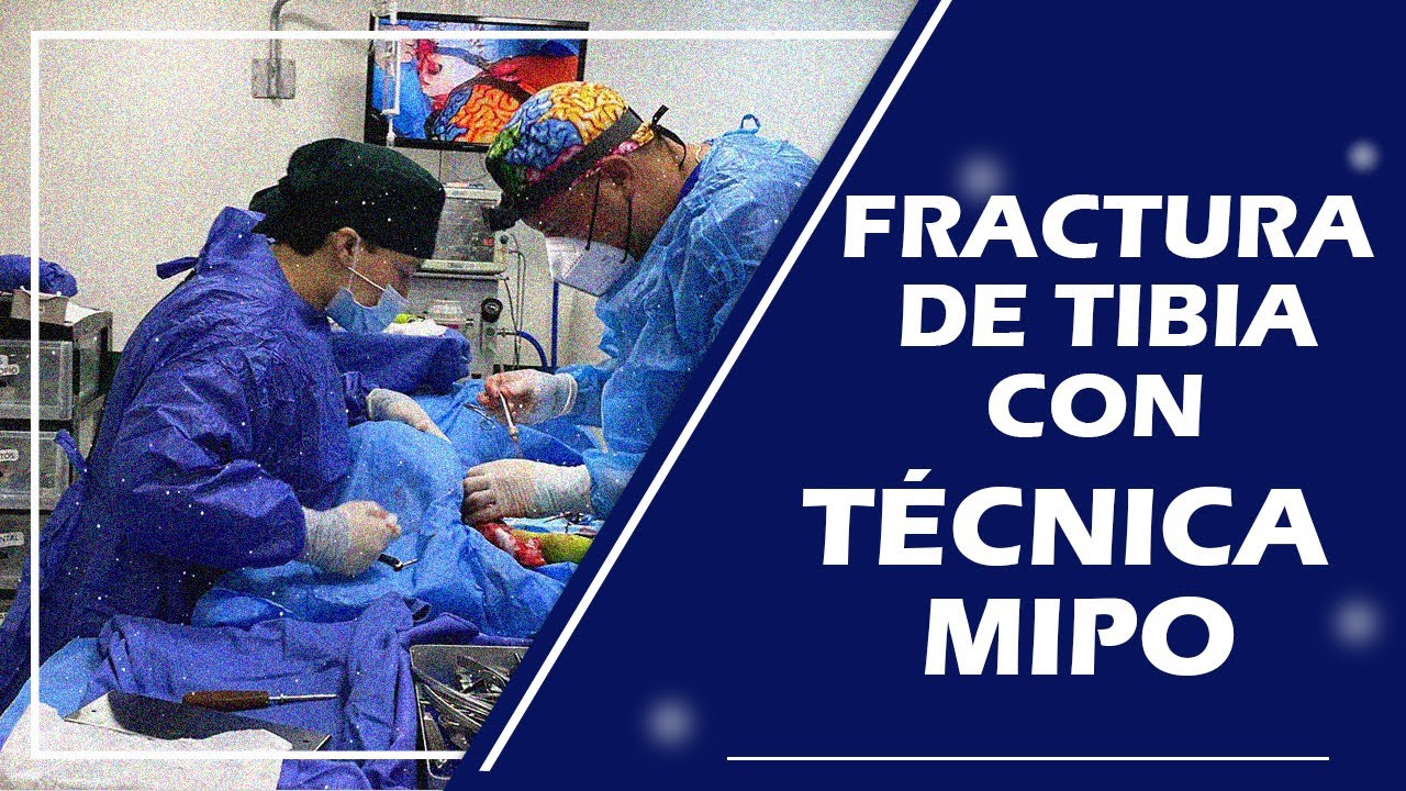 Fractura de tibia con técnica mipo ¿Cómo se realiza? - YouTube