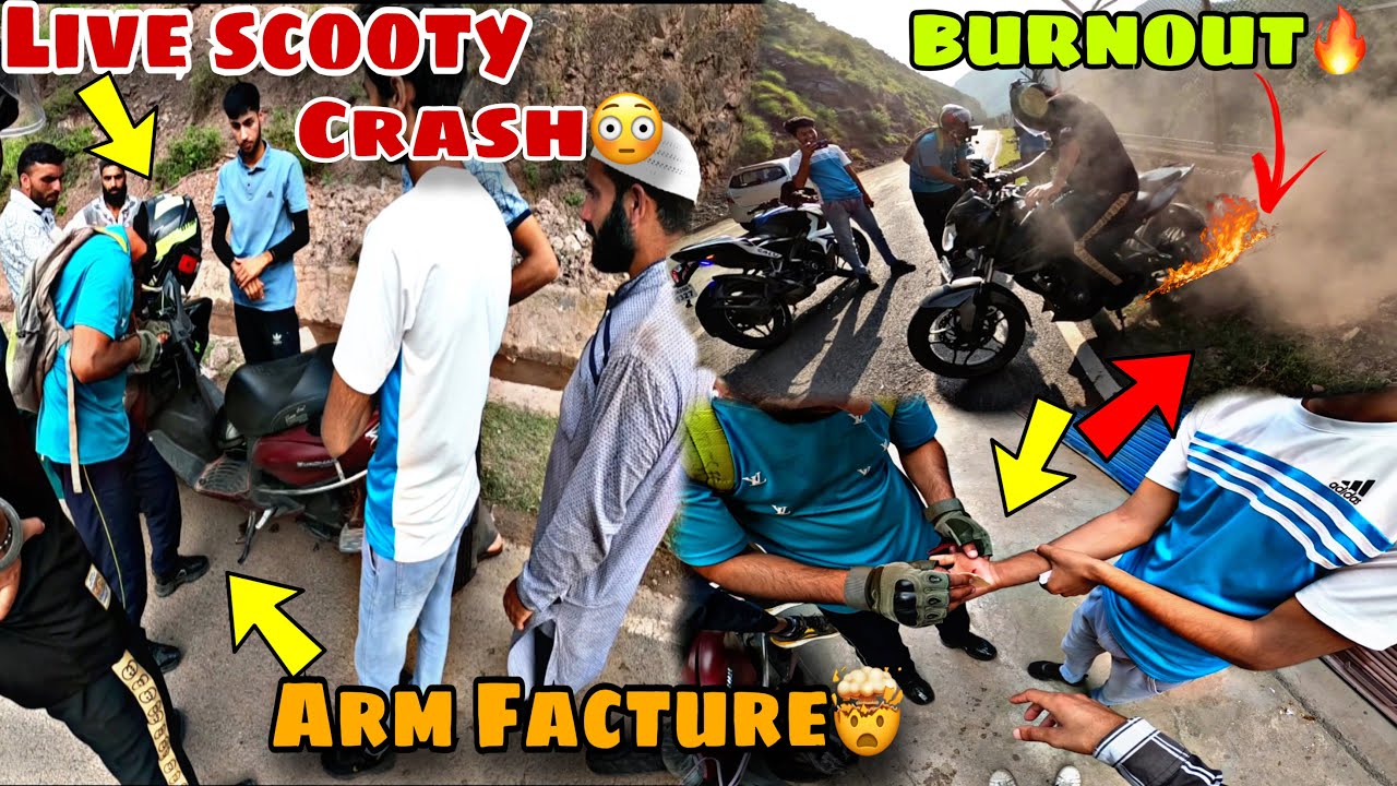 Scooty Accident Capture on my Gopro 💔 || Hyper Ride 🔥 || Crazy Burnout ...