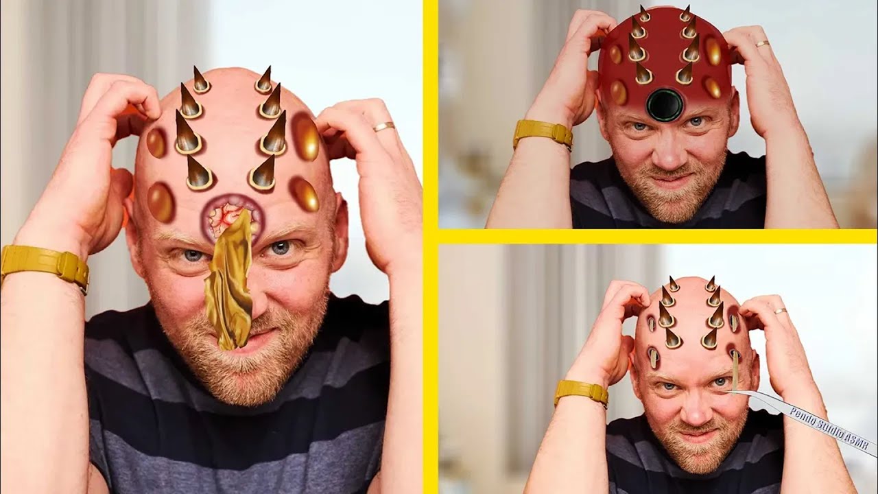 ASMR worm removal | Huge maggots removal - YouTube