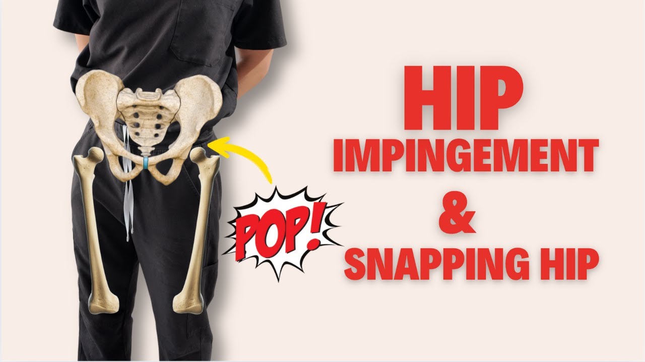 Why Your Hip Pops, Snaps, Cracks and How to Fix it FOR GOOD - YouTube