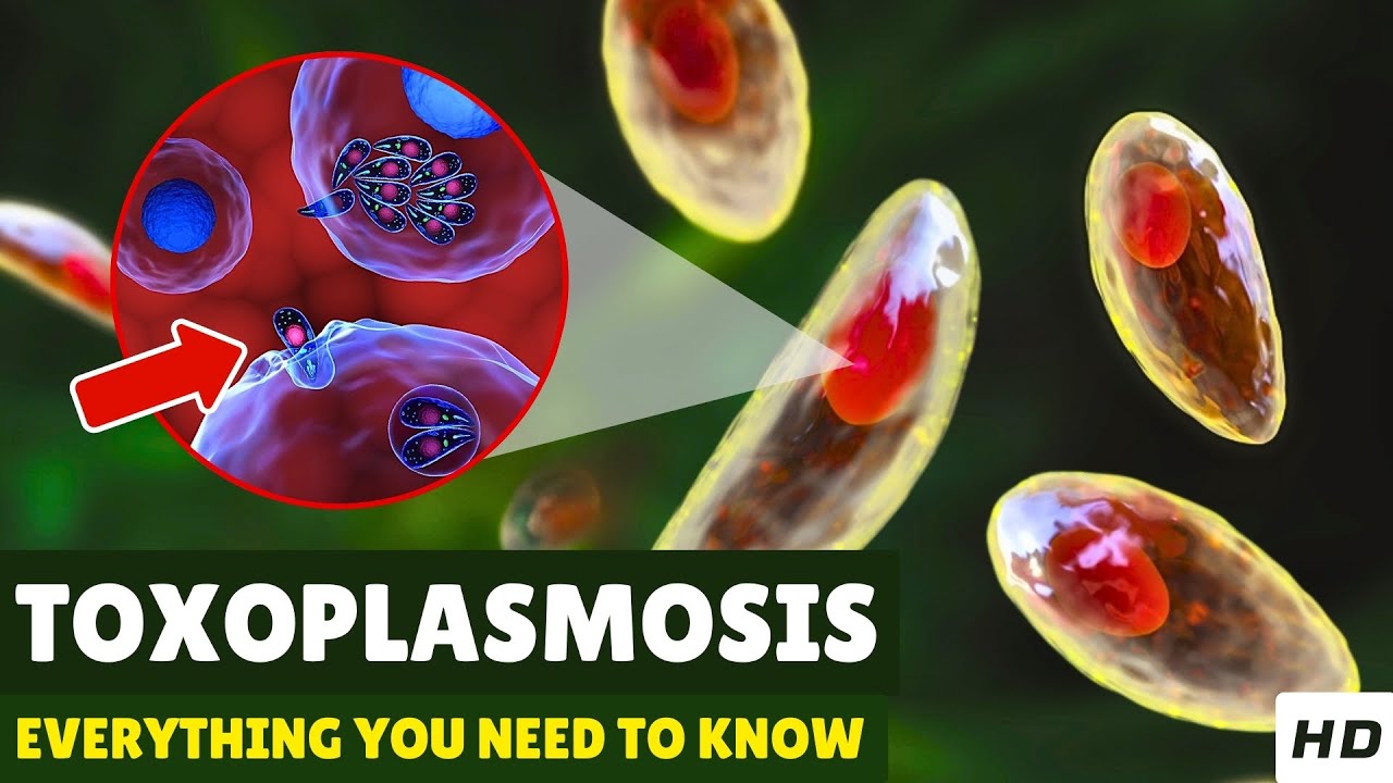Toxoplasmosis – Causes, Signs and Symptoms, Diagnosis & Treatment - YouTube