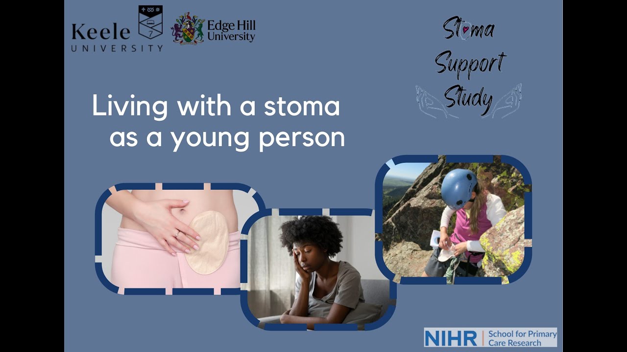 Living with a stoma as a young person - YouTube