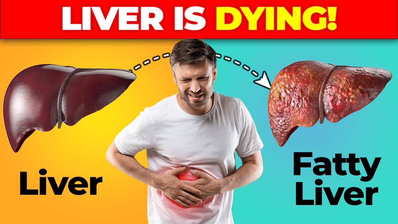 Fatty Liver: Causes, Symptoms, Treatment, and Prevention - SUPERHERO ...