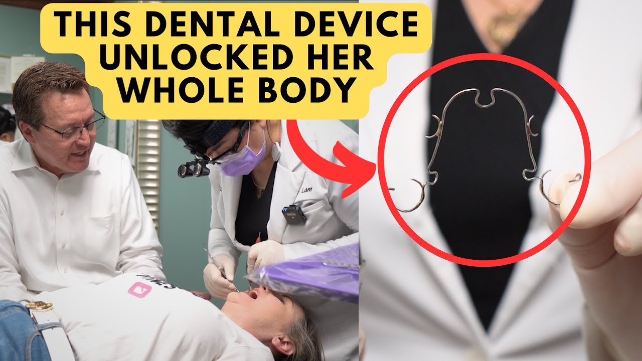 Case Study: This Dental Appliance Changed Her Body From Head To Toe ...