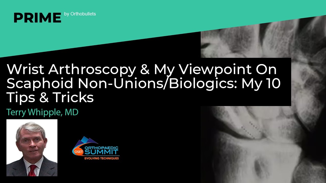 Wrist Arthroscopy & My Viewpoint On Scaphoid Non-Unions/Biologics ...