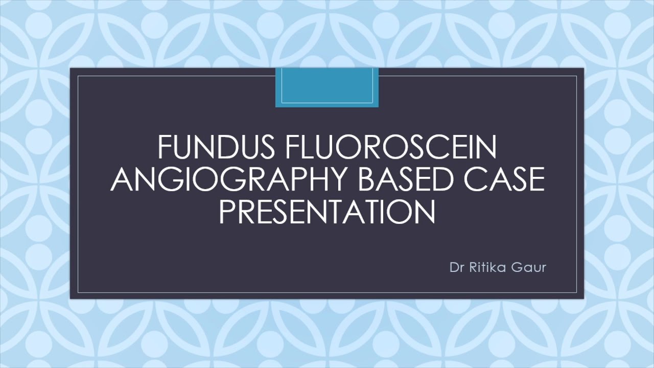 Fundus Fluoroscein Angiography Based Case Presentation,, Dr Ritika Gaur, 04 Aug, 2022 - YouTube