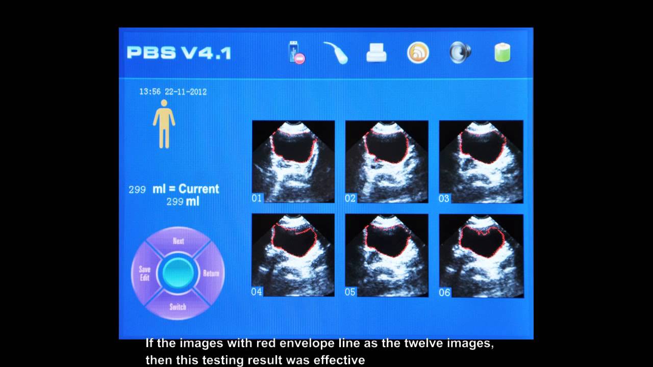 Bladder Scanner PBSV4.1-Mianyang Meike Electronic Equipment Co., Ltd ...