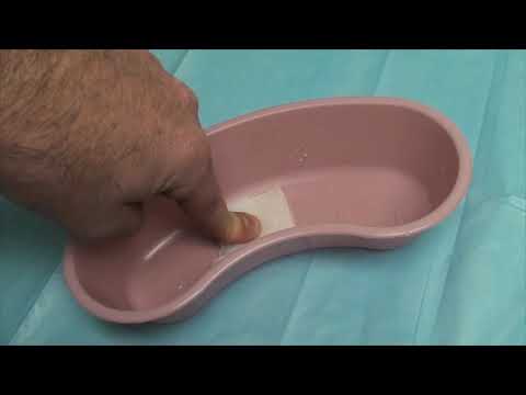 Treatment of a Fingertip Amputation - YouTube