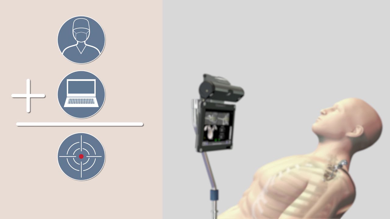 EQUINOXE ExactechGPS Shoulder - YouTube