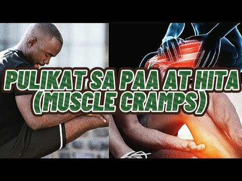 PULIKAT SA PAA AT HITA(MUSCLE CRAMPS)ALAMIN NATIN|Philippines - YouTube