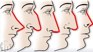 Types Of Noses Chart